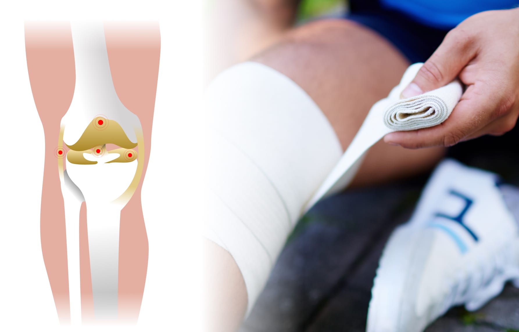 5 Most Common Knee Injuries in Sports: A Complete Guide for Athletes